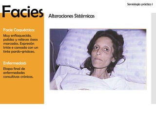Facies Anormales | PDF