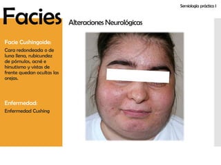 Facies Anormales | PDF
