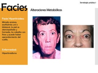 Facies Anormales | PDF