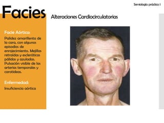Facies Anormales | PDF