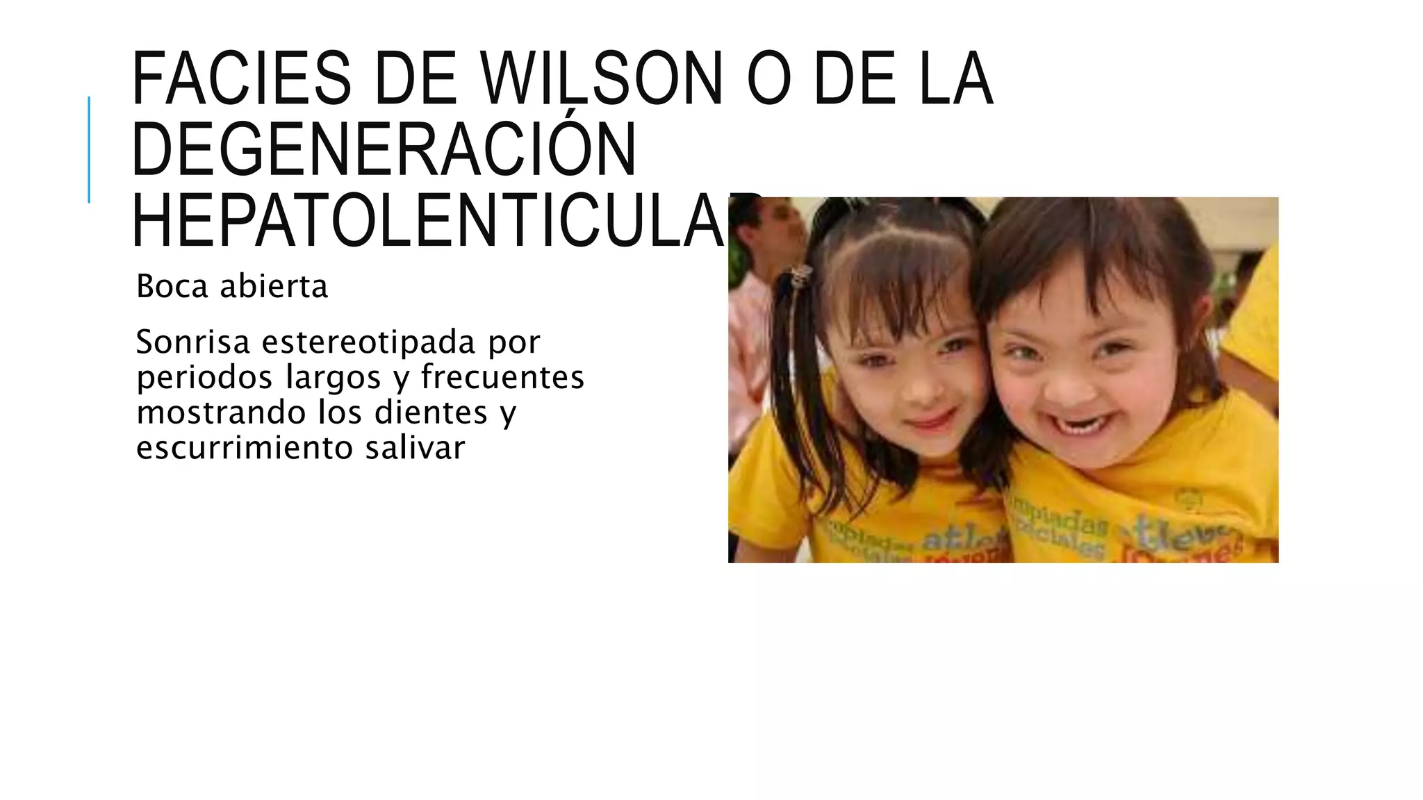 Facies, marcha y actitud | PPTX