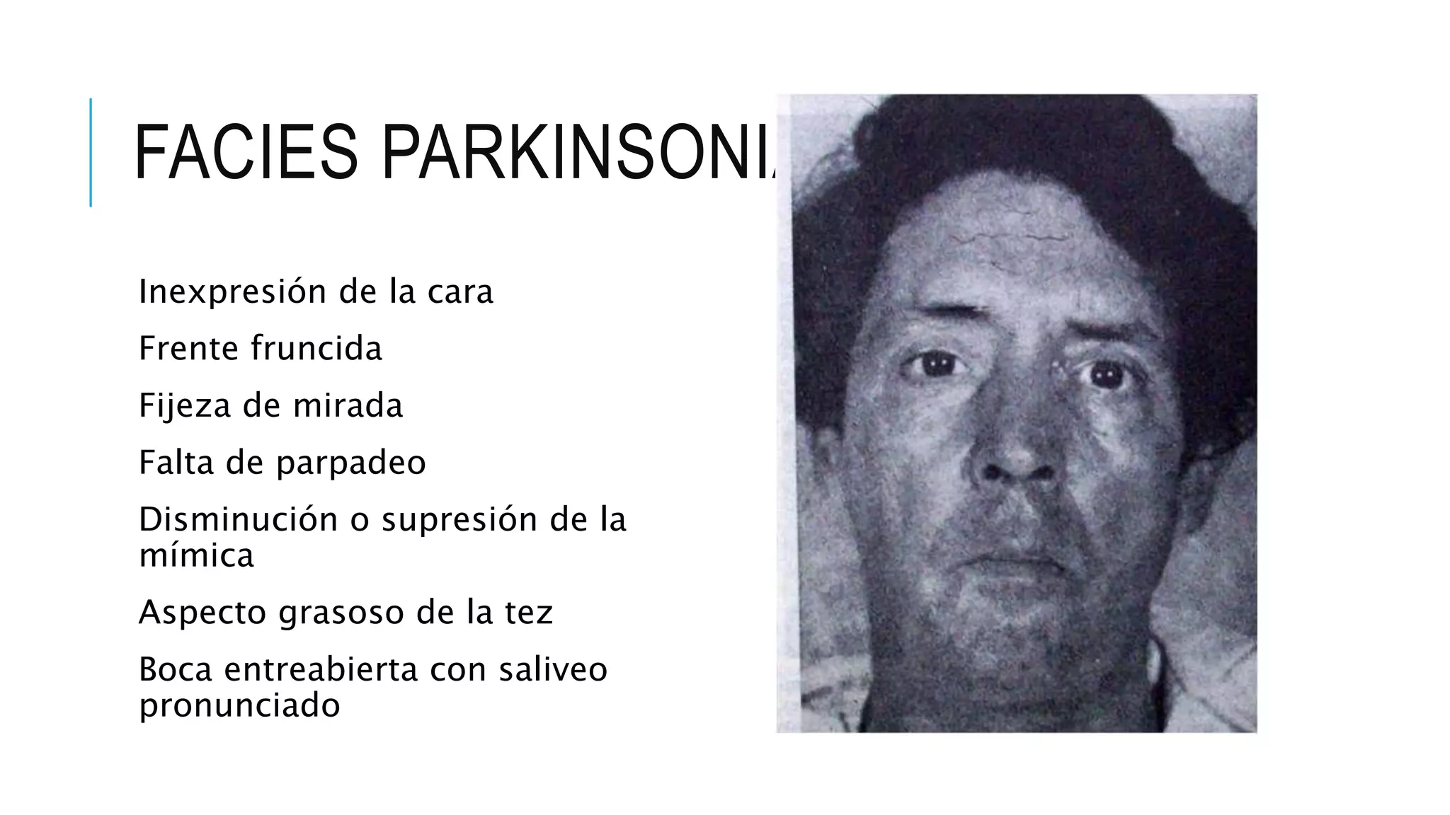Facies, marcha y actitud | PPTX