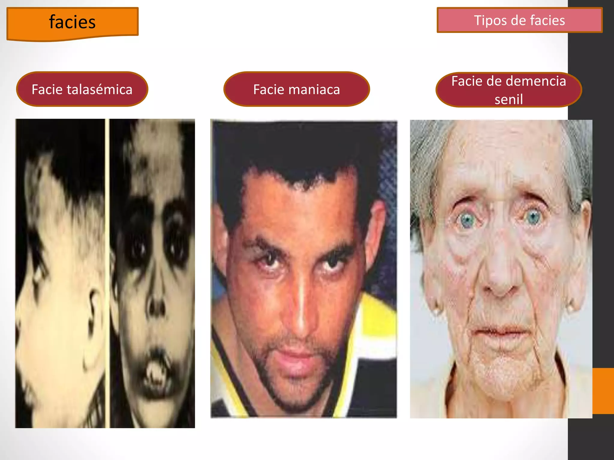 Facies, postura y marcha | PPTX