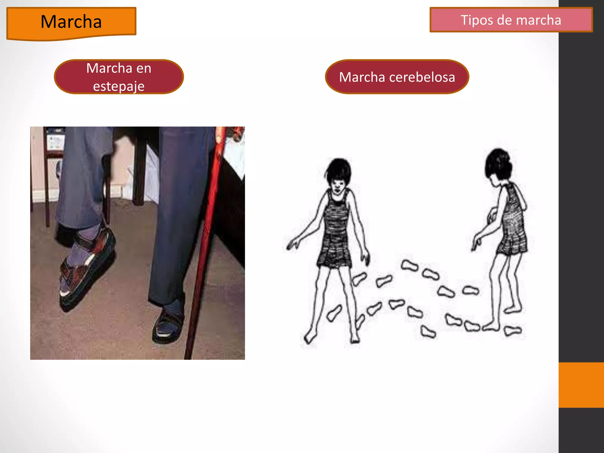 Facies, postura y marcha | PPT