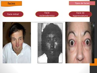 Facies, postura y marcha | PPTX
