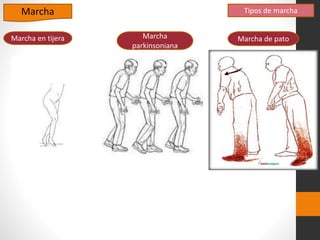Facies, postura y marcha | PPTX