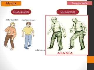 Facies, postura y marcha | PPTX