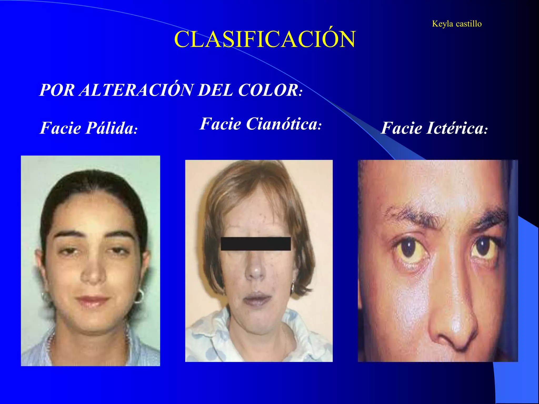 Facies semiologia | PPTX