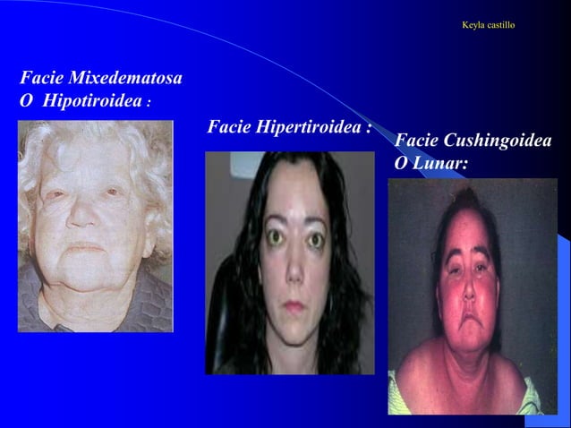 Facies semiologia | PPTX