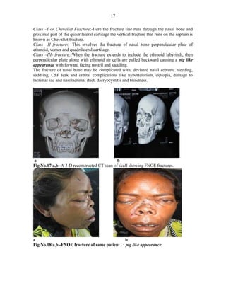 Faciomaxillary emergencies are_multidisciplinary_problems | PDF