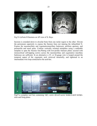 Faciomaxillary emergencies are_multidisciplinary_problems | PDF