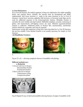 Faciomaxillary emergencies are_multidisciplinary_problems | PDF