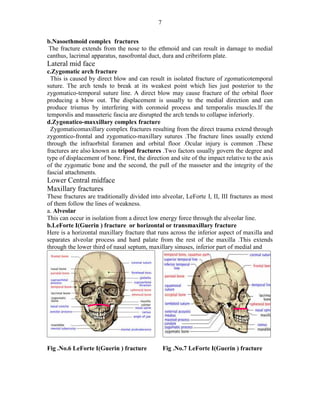 Faciomaxillary emergencies are_multidisciplinary_problems | PDF