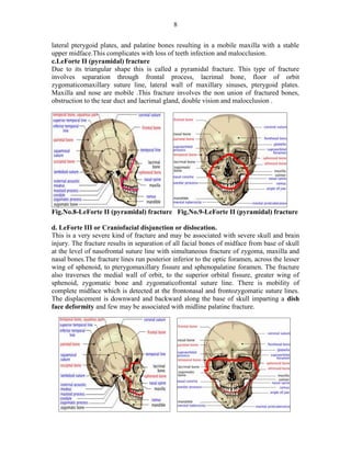 Faciomaxillary emergencies are_multidisciplinary_problems | PDF