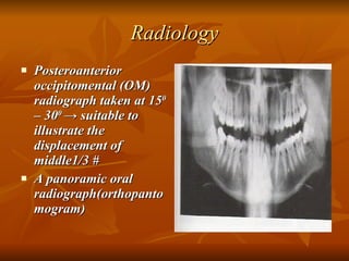 Faciomaxillary Injuries | PPT