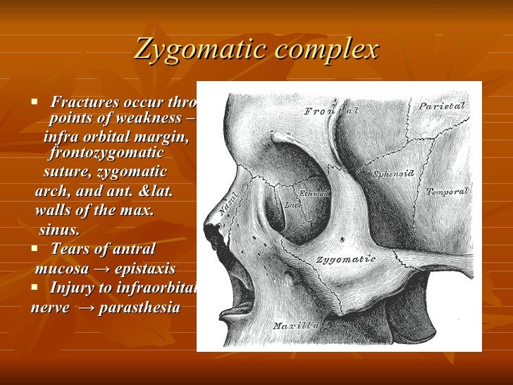 Faciomaxillary Injuries