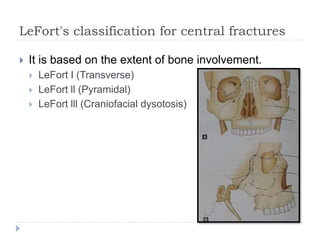 Faciomaxillary Injuries | PPTX
