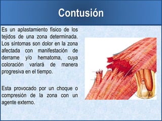 Factores de riesgo en la actividad física | PDF