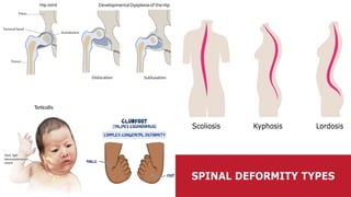 Factors affecting Body Alignment (Mobility & Immobility)pptx | PPTX