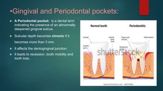 Factors affecting dentogingival junction | PPTX