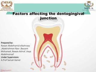 Factors affecting DGJ | PPTX