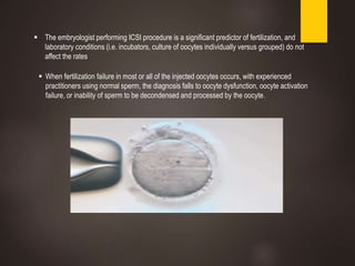 Factors affecting fertilization in icsi | PPTX