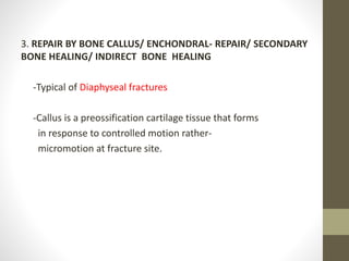 Factors affecting fracture healing | PPTX