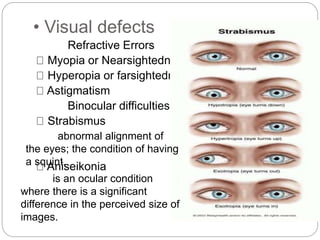 Factors affecting reading (2) | PPTX