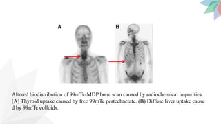 Factors affecting the biodistribution of radiopharmaceuticals | PPTX