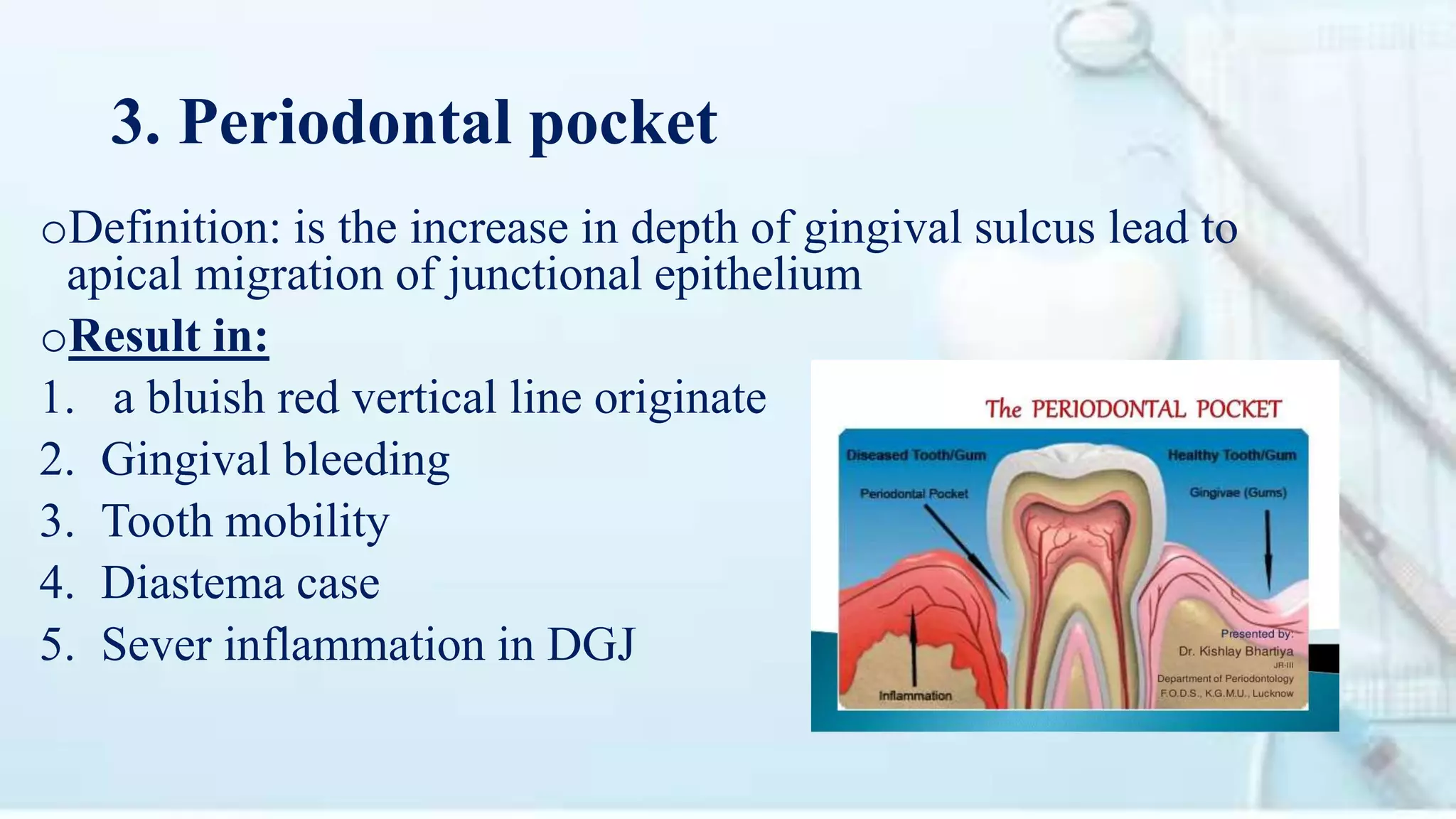 Factors affecting the dgj | PPTX