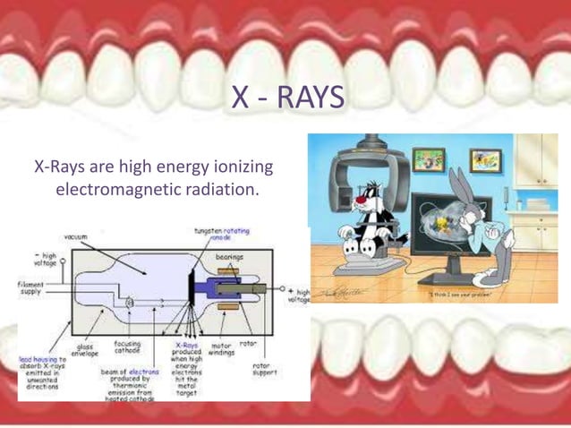 Factors controlling the beam of x-ray | PPTX