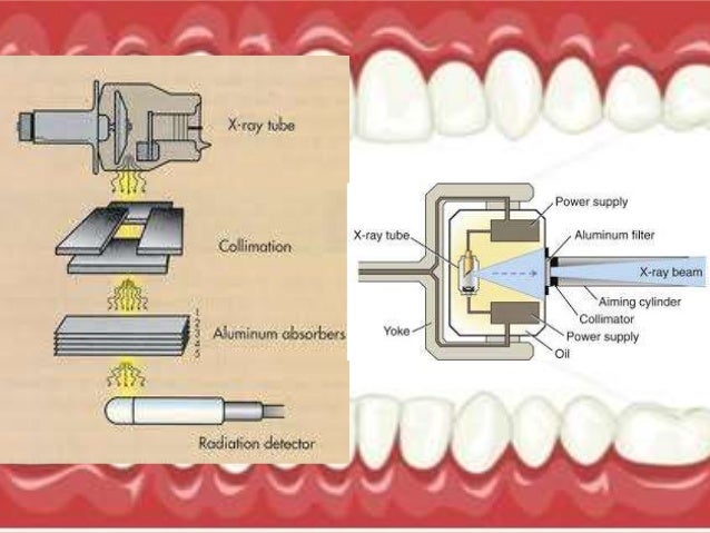 Factors controlling the beam of x-ray