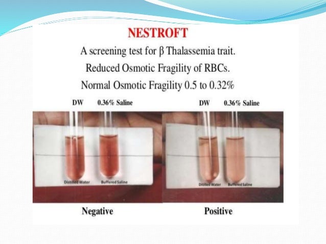 Factors influencing fetal growth and development