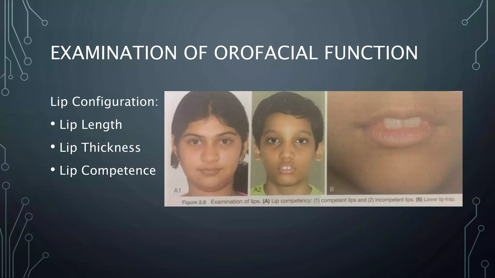 Factors influencing orthodontic treatment planning | PPTX