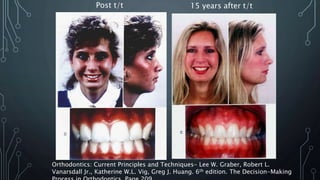 Factors influencing orthodontic treatment planning | PPTX