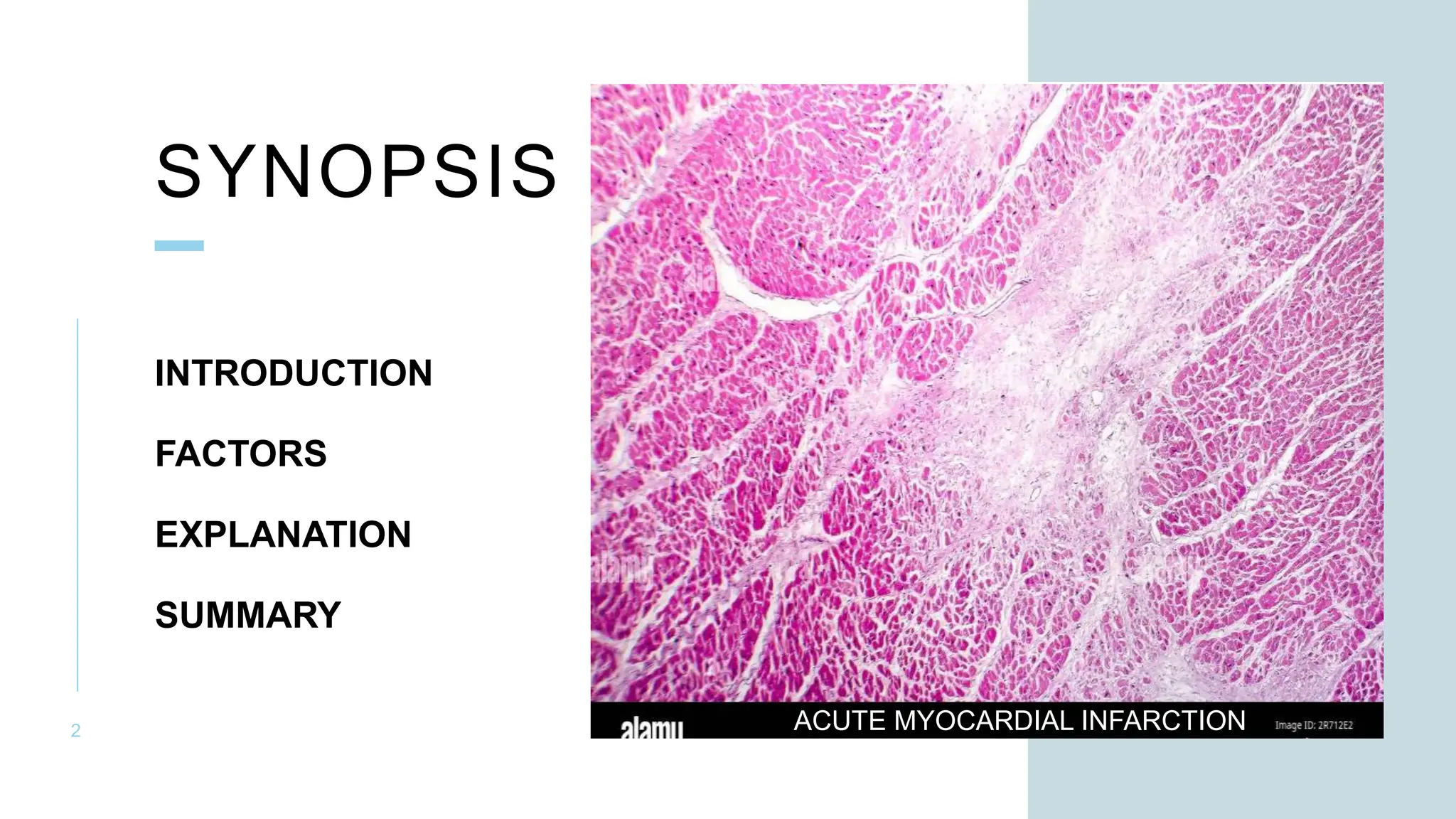 Factors influencing the development of an infarct.pptx