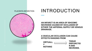 Factors influencing the development of an infarct.pptx