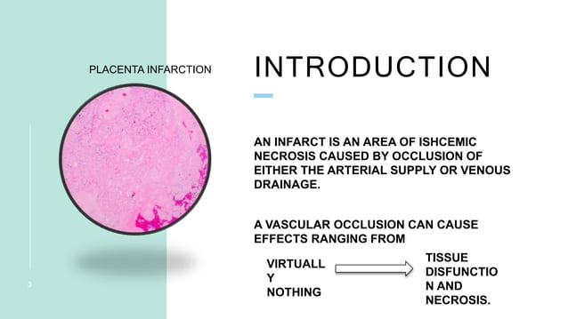 Factors influencing the development of an infarct.pptx