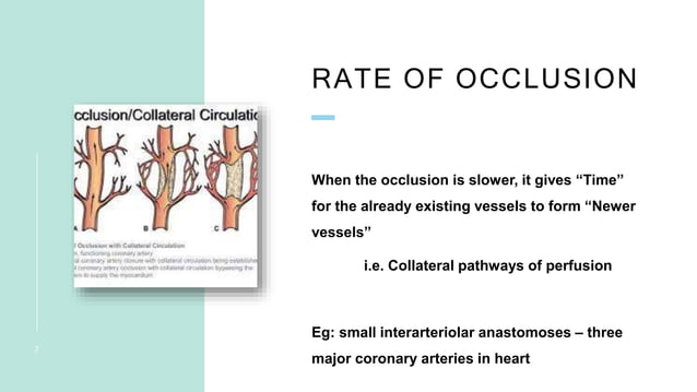 Factors influencing the development of an infarct.pptx