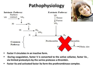 Factor v deficiency | PPTX