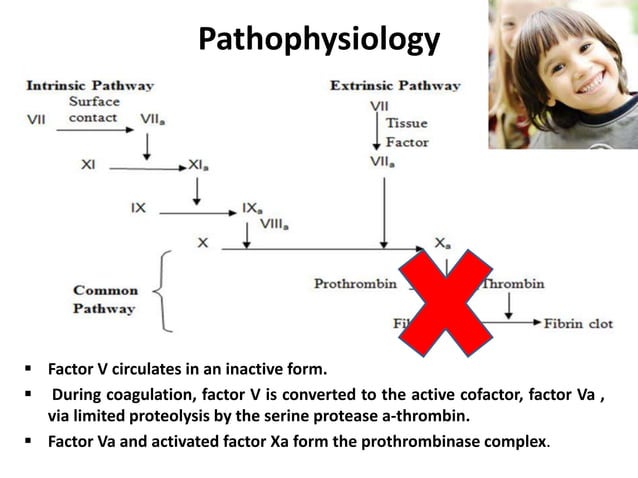 Factor v deficiency | PPT