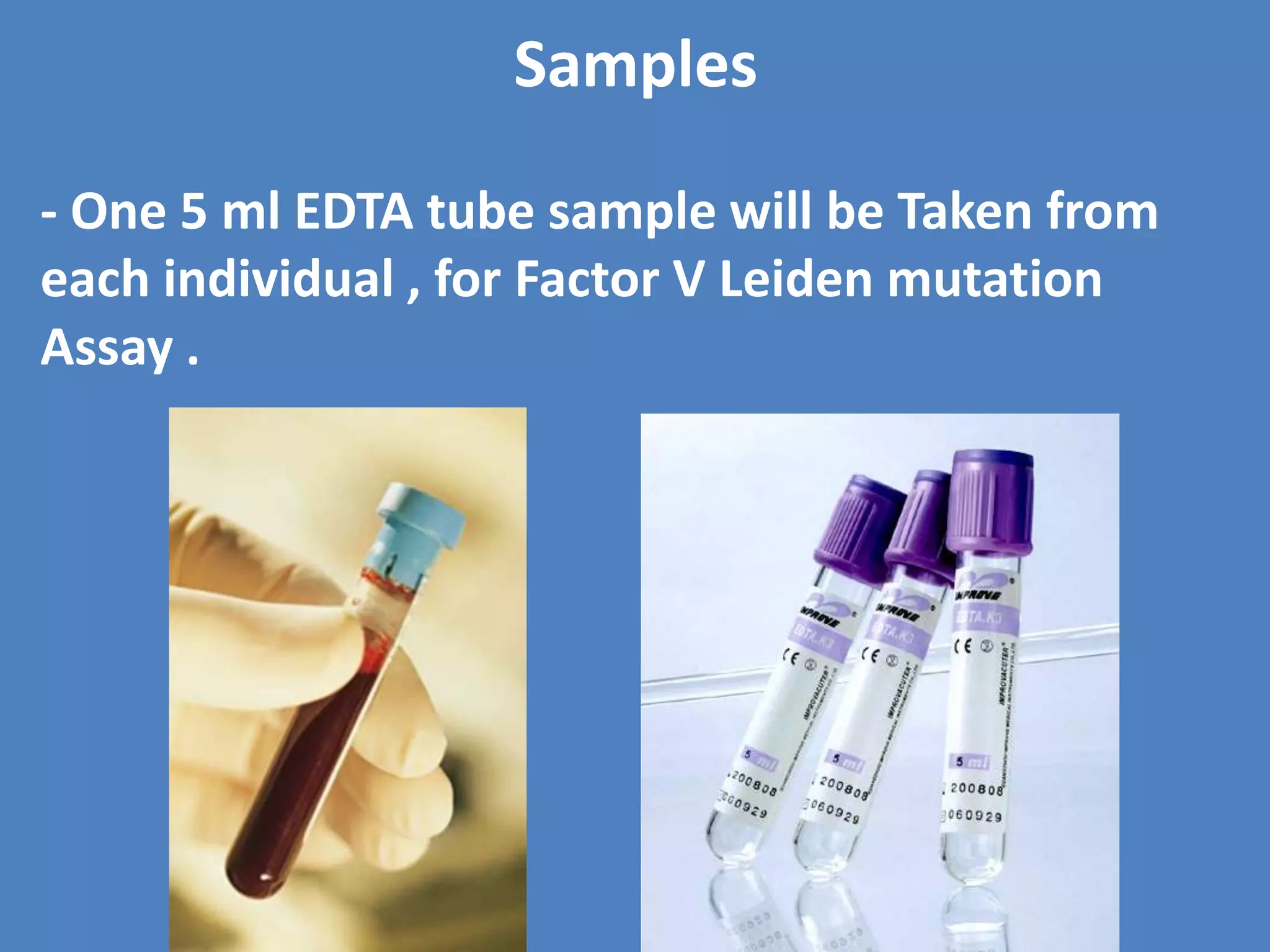 Factor v leiden in abortion | PPTX