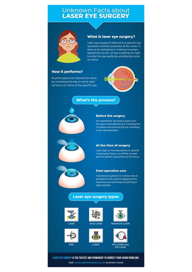 Interesting Facts about Laser Eye Surgery | PDF
