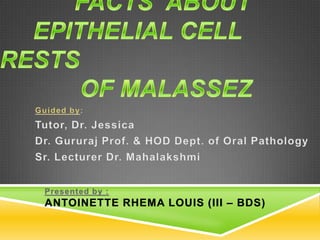 Facts of erm | PPTX
