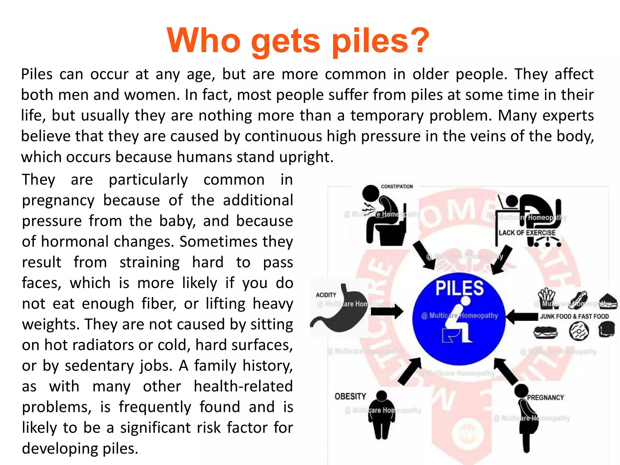 Facts to know about piles and the scope of homeopathy treatment in ...