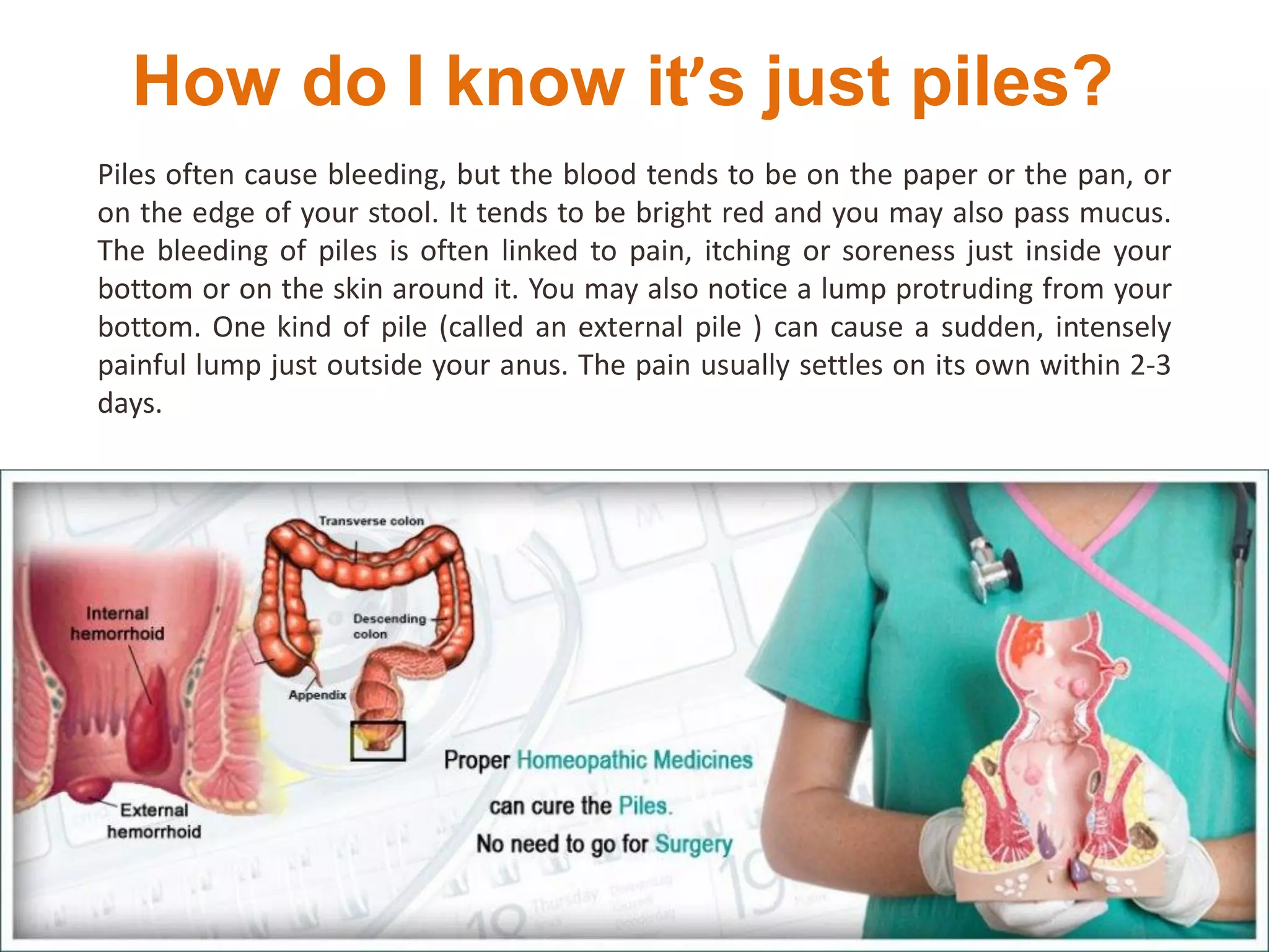 Facts to know about piles and the scope of homeopathy treatment in ...