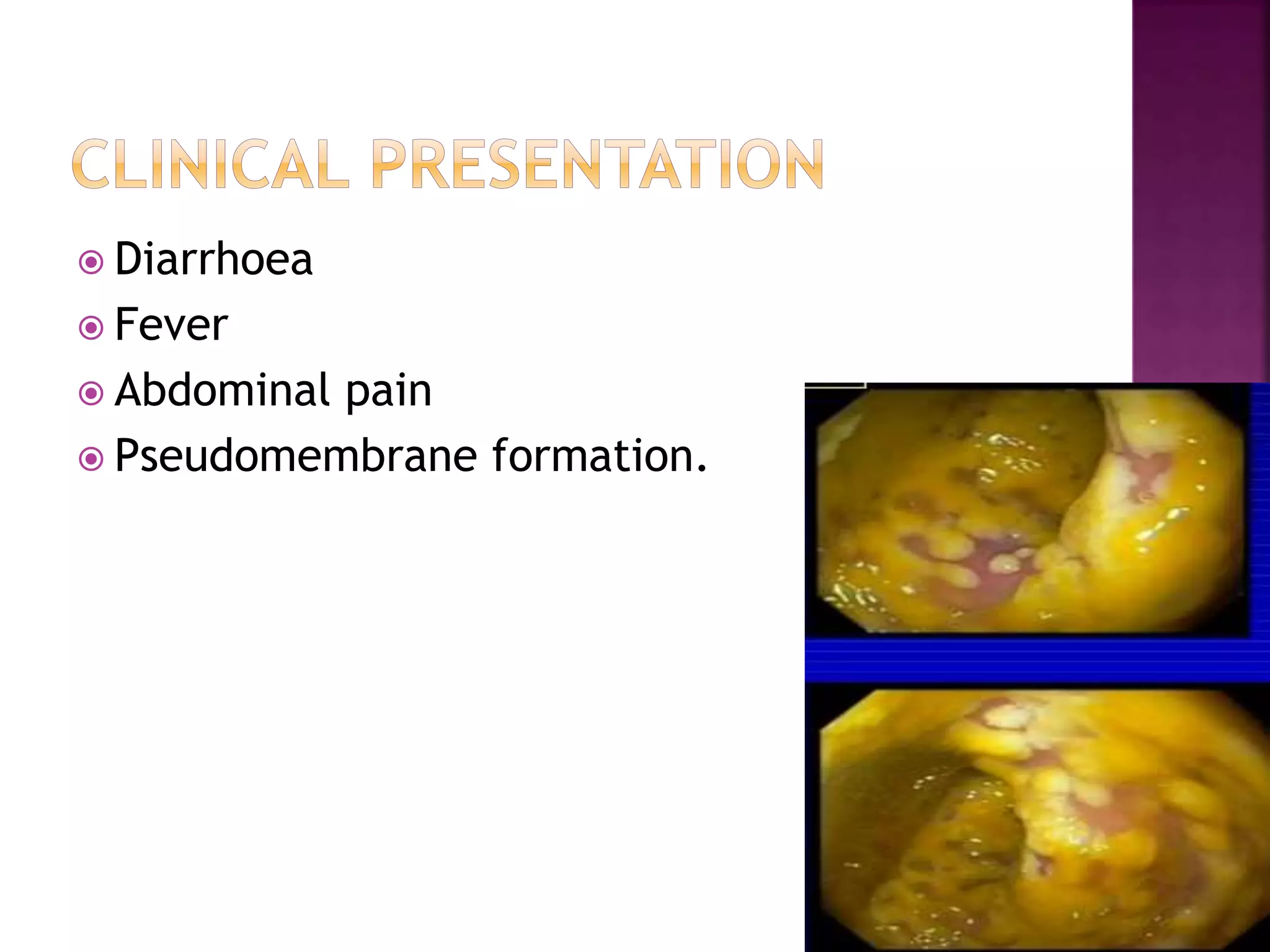 Faecal microbiota transplantation | PPTX