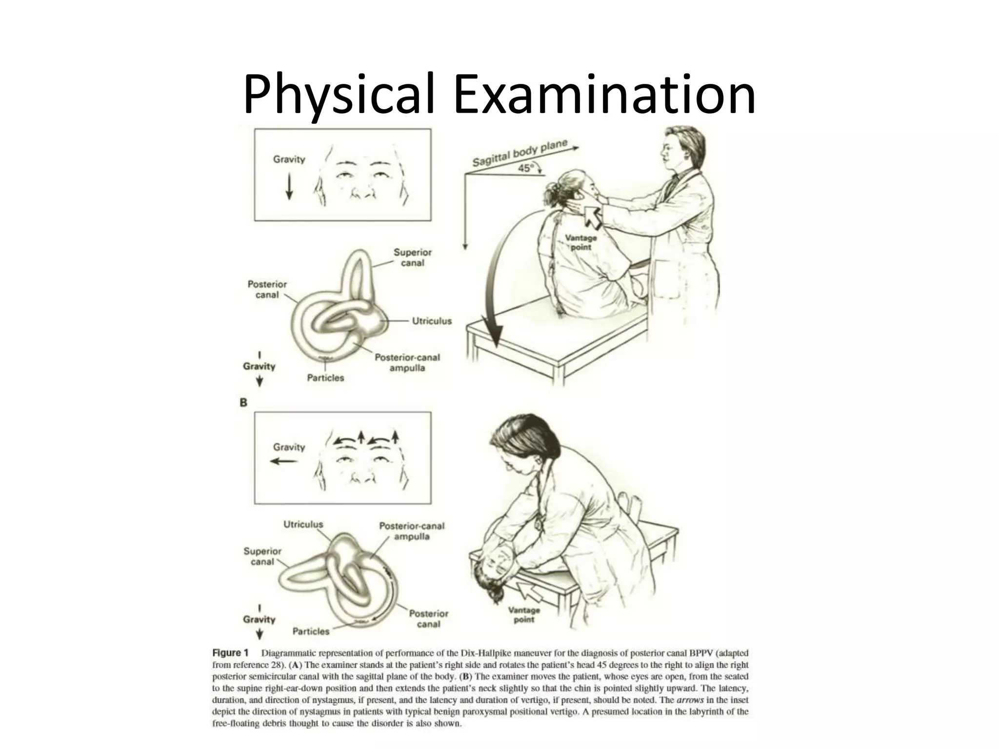 Approach to Dizziness and Vertigo in Emergency Department | PPTX