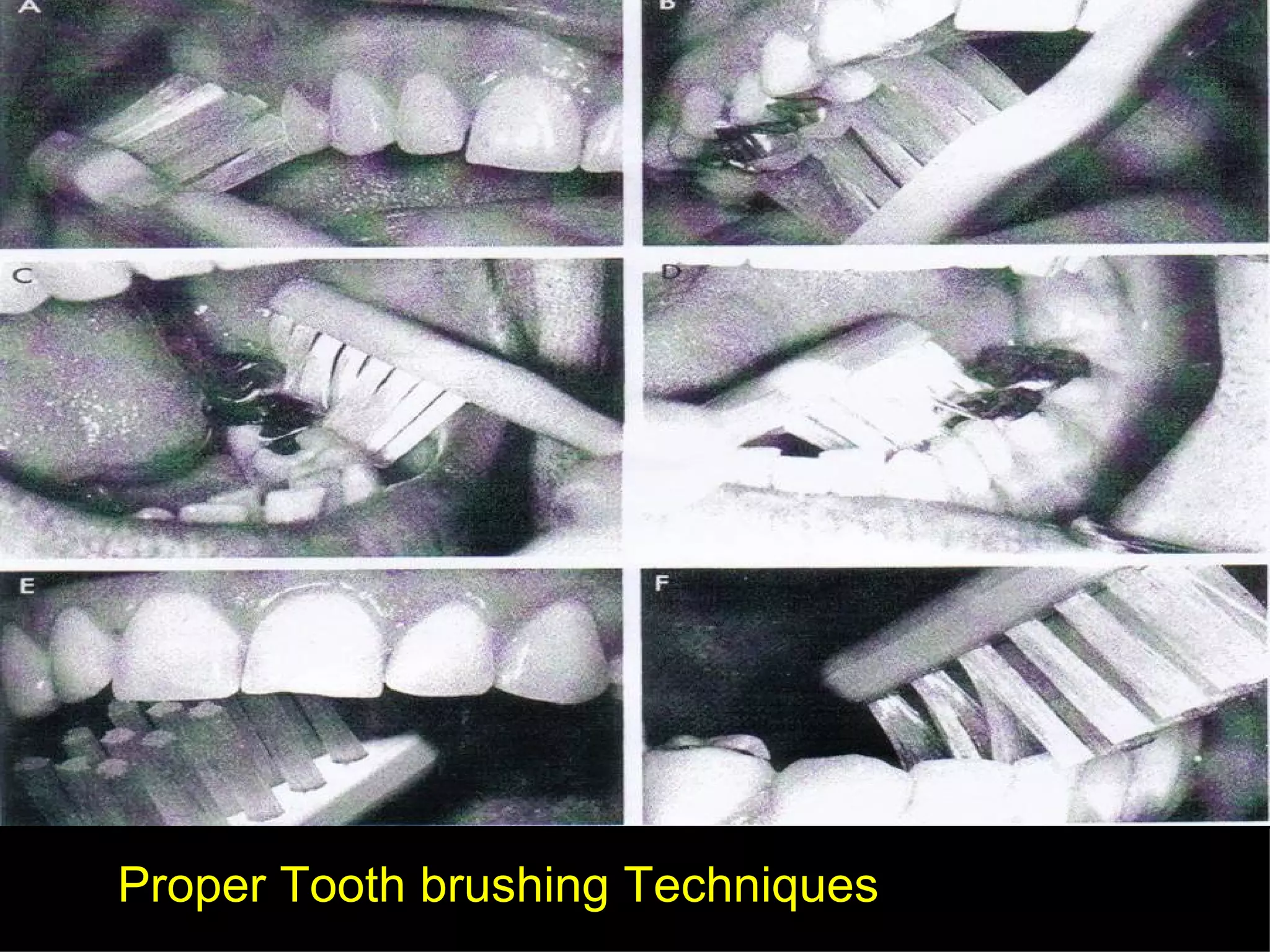 Dental Health Education | PPT