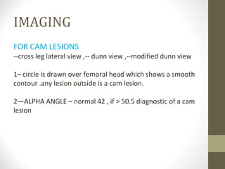 Femoro-acetabular impingement syndrome | PPT